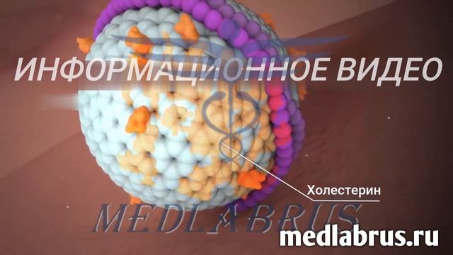 Гиперлипидемия (высокий уровень холестерина)