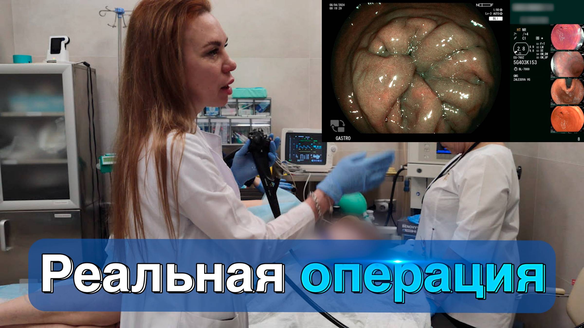 Как проводится гастроскопия под наркозом