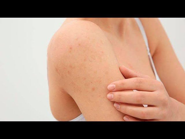 Проблемы с кожей (ч.1.)