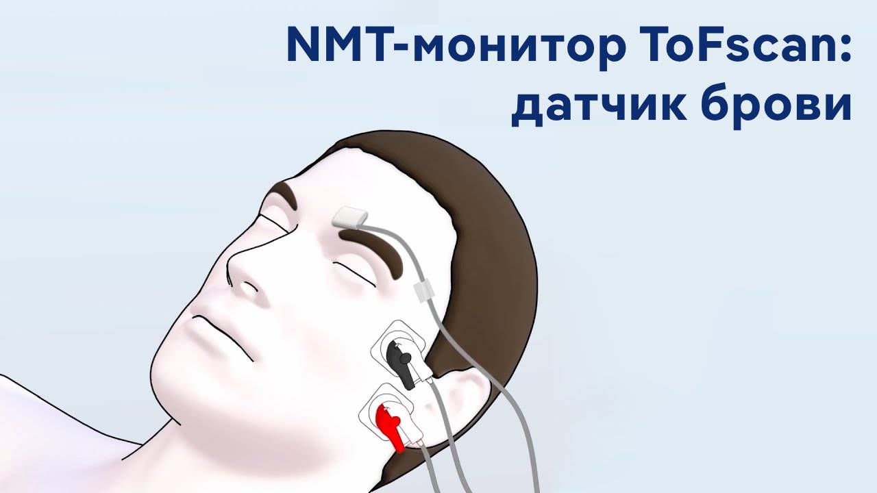 ToFscan: монитор нейромышечной проводимости. Установка датчика брови и процедура измерения