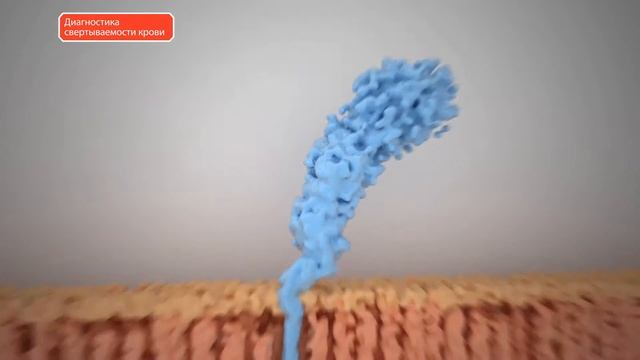 Роснано: диагностика свертывания крови