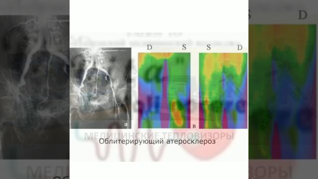 Лекция 2 курс. Тема 3.1. Субъективное обследование хирургического и травматологического пациента