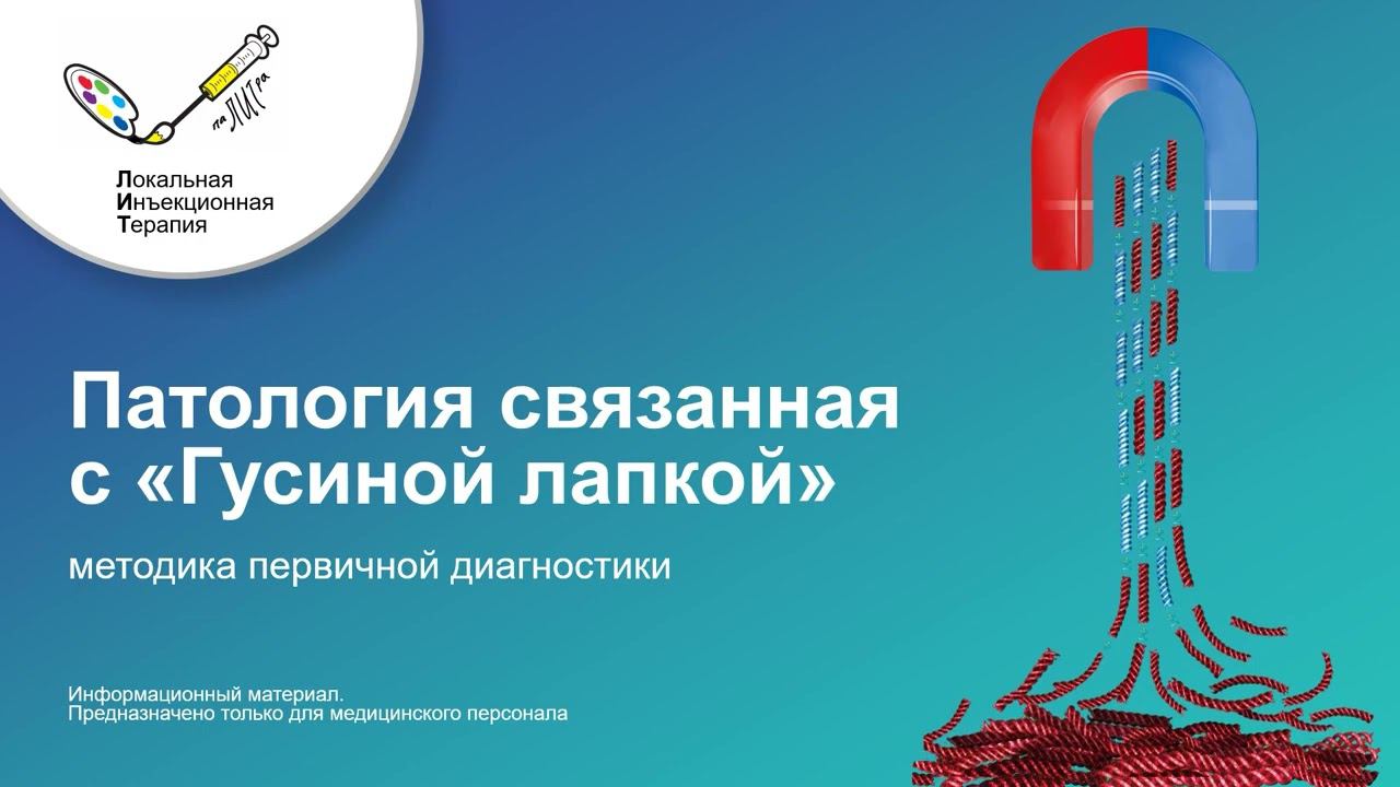 Патология Связанная С Гусиной Лапкой Методика Диагностики