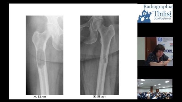 Лучевая диагностика скелетной онкологии. Клинические случаи