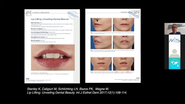 Jorge Andre Cardosso вебинар "Протезирование с основой на имплантаты"