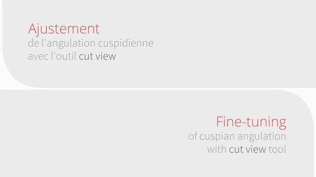 Modjaw. Анализ динамических окклюзий