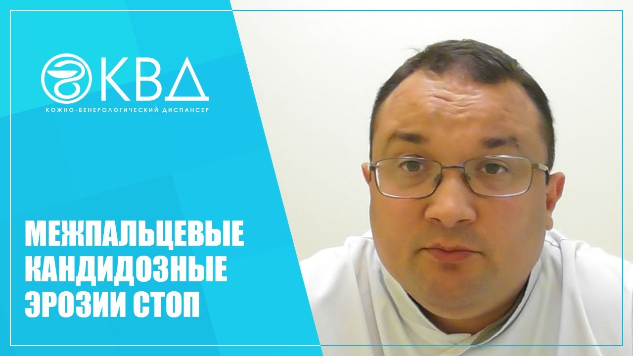 1418  Межпальцевые кандидозные эрозии стоп