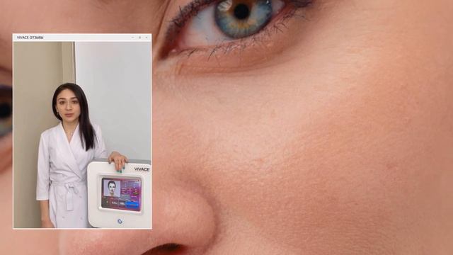 Отзывы врачей об аппарате VIVACE. Клиники Еврокосмо и New Age (Барнаул), Беллая Аллея (Архангельск)