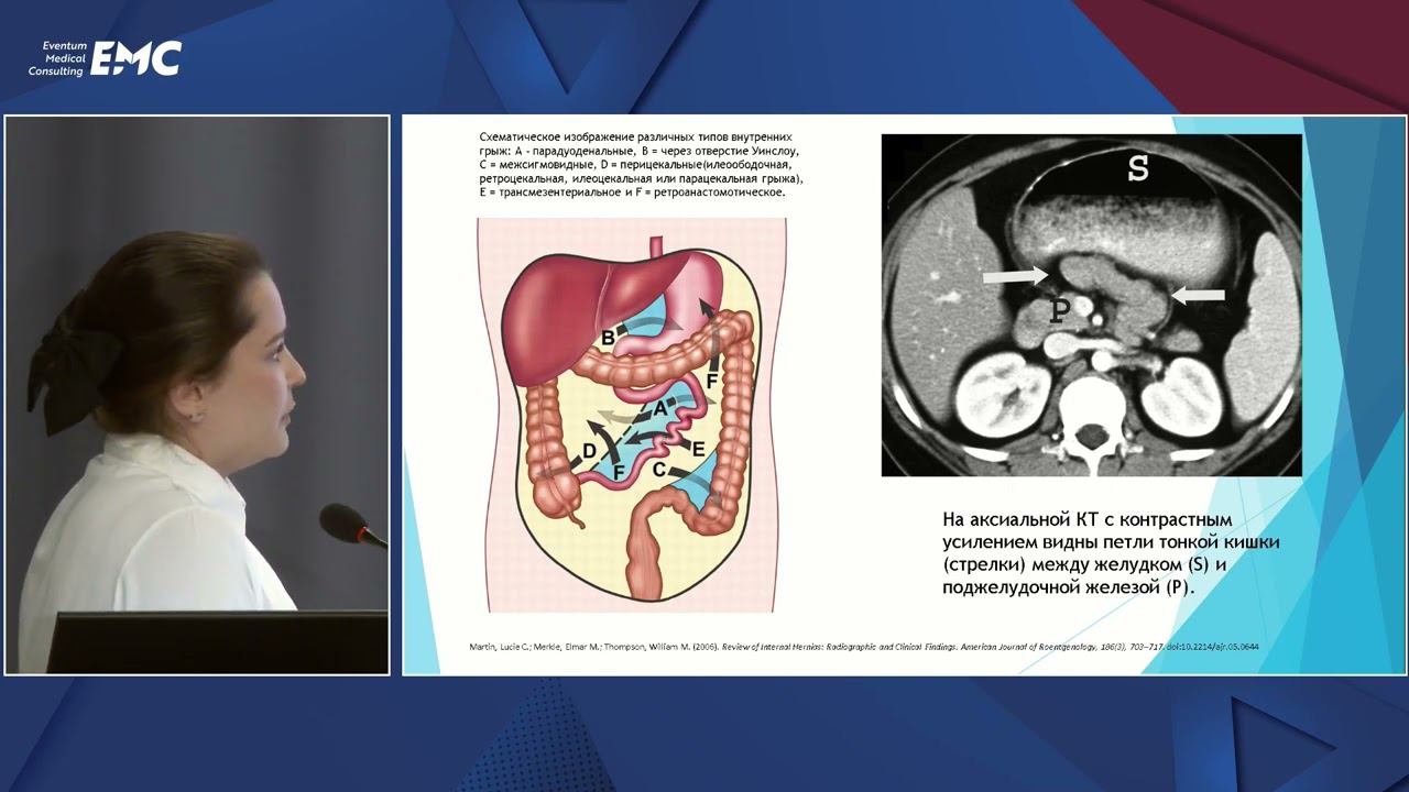 12 Алгоритм лучевой диагностики при острой кишечной непроходимости - Шандарова С.Ю.