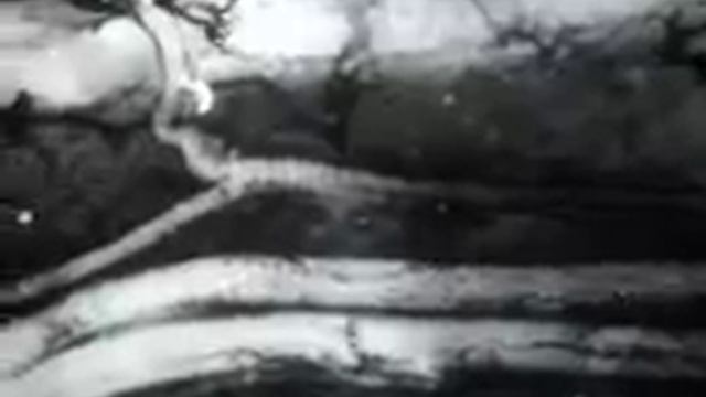 Строение и свойства нервной ткани