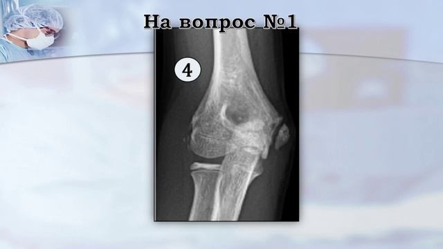 Ситуационная задача на тему: "Верхняя конечность"