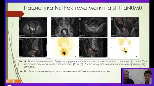 Определение сторожевых ЛУ у больных раком эндометрия: проблемы и перспективы (РФП Сентискан)