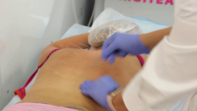 Оригитея: иглотепия метод "Гормонизация"