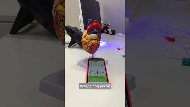 Как узнать, есть ли у вас аритмия?