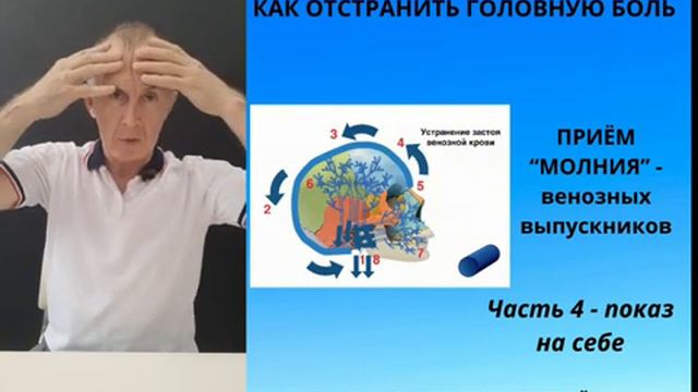 КАК УСТРАНИТЬ ГОЛОВНУЮ БОЛЬ. РАСКРЫТИЕ ЦЕНТРАЛЬНОГО ВЕНОЗНОГО КАНАЛА. Часть 4.