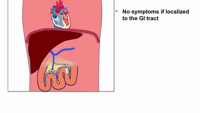 USMLE RX - 3.Эндокринная система - 3.Патология - 3.Карциноидный синдром