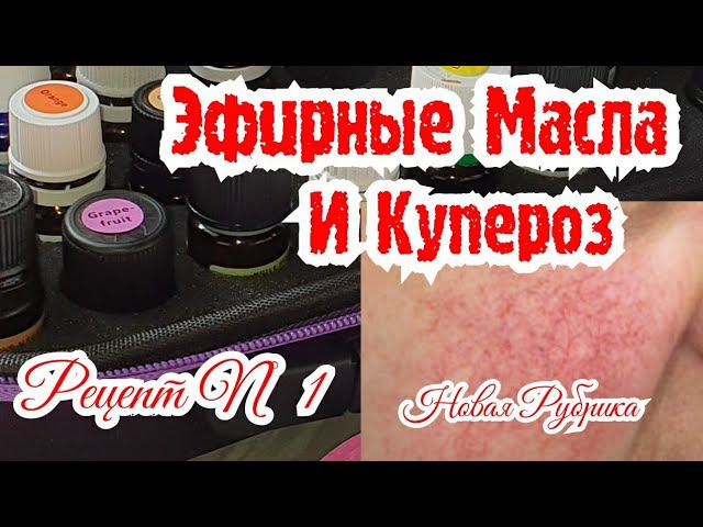 КУПЕРОЗ. ЭФИРНЫЕ МАСЛА ЛЕЧАТ ВСЁ!  РЕЦЕПТ N° 1 для тех  у кого есть купероз и розацеа/Couperose