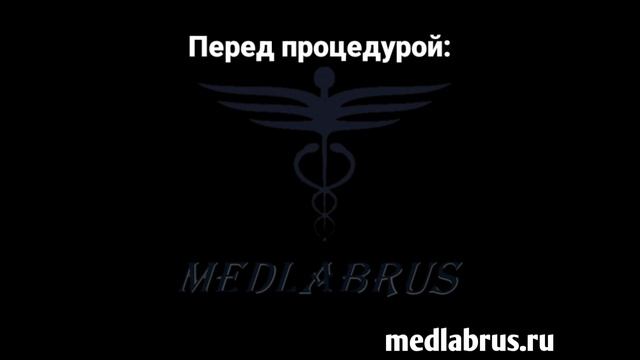 Родоразрешение  с помощью кесарева сечения