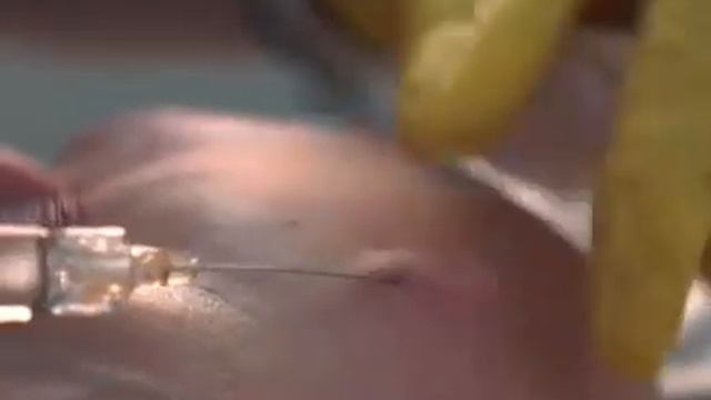 Ialest Mastelli практическое применение