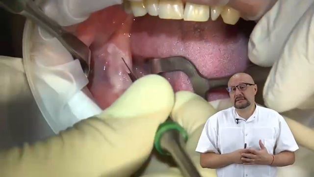 «Что посеешь, то и пожнешь»