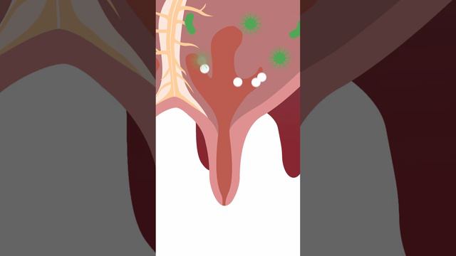 Энрофлон: лечение мастита у коров