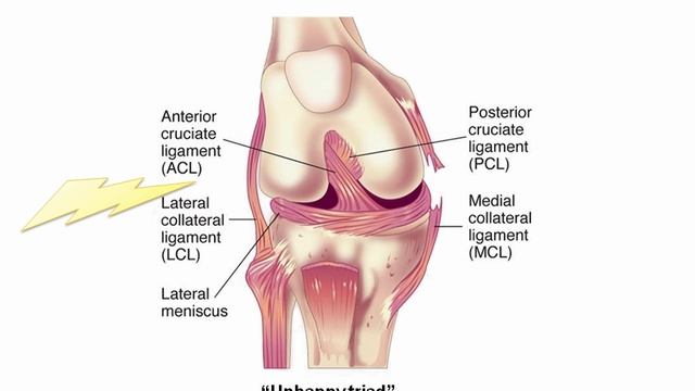 USMLE RX - 8.Анатомия - 1.Анат,физо - 4.Заболевания тазобедренного и коленного суставов