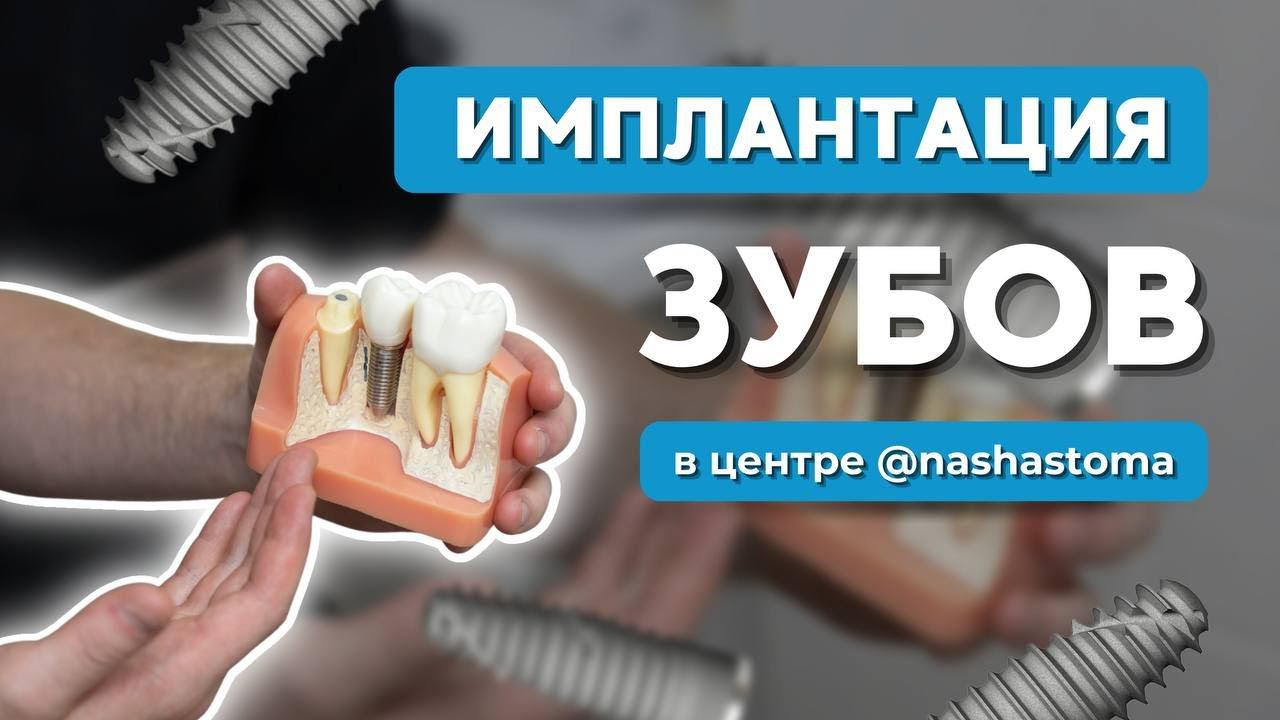Имплантация зубов в СПб