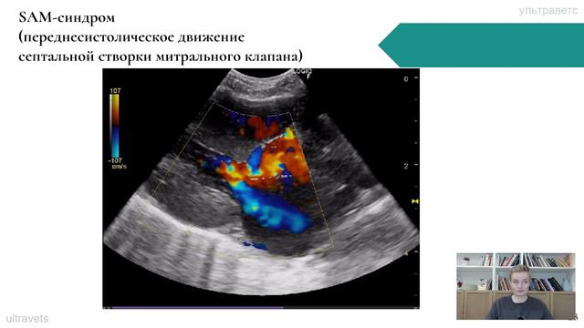 ВНУТРИ КУРСА | Перикардиты, ЛГ, дирофиляриоз, SAM, эндокардит| Онлайн-курс по терапии кардиопациента
