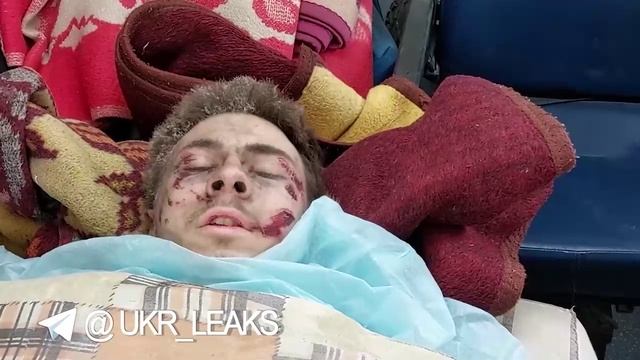 Раненный пленный ВСУшник. 31.04.2022