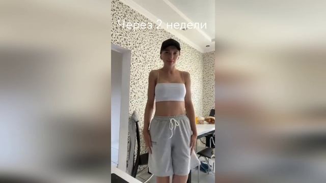 Две недели после увеличения груди