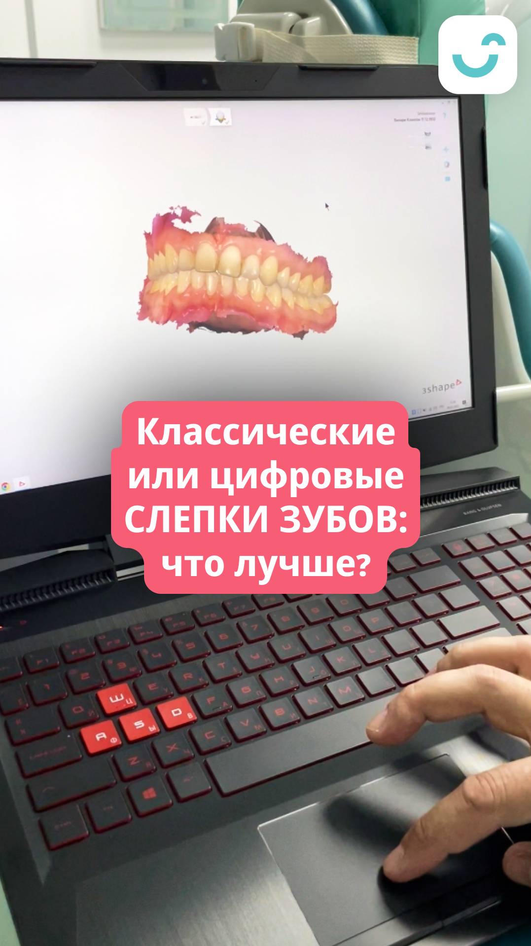 Как создаются цифровые слепки зубов