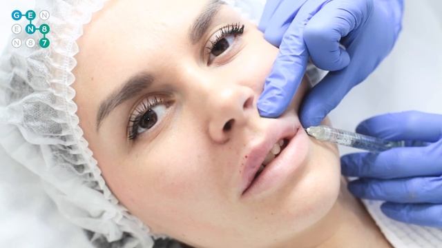УВЕЛИЧЕНИЕ ГУБ, КОРРЕКЦИЯ ФОРМЫ И ОБЪЕМА ГУБ Сеть клиники косметологии GEN87