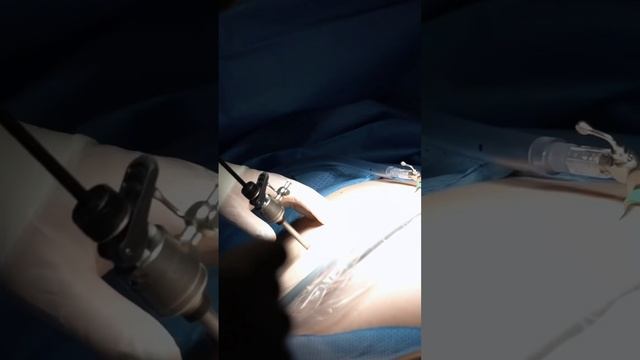 Технология Fast Track-хирургии