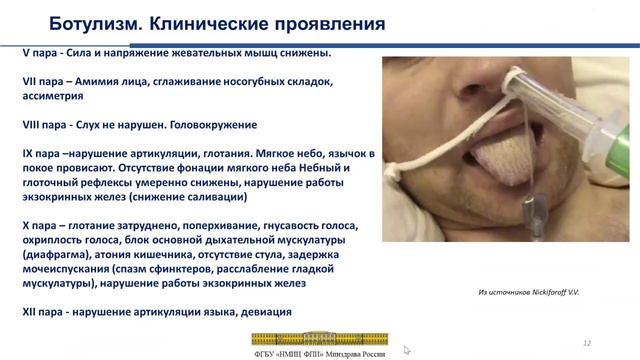 Ботулизм: этиология, клинико-лабораторная диагностика, лечение