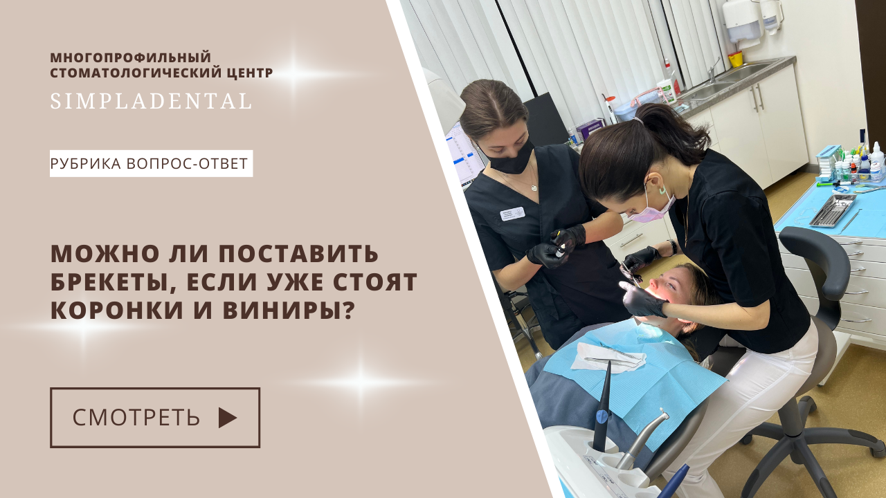 Возможно ли исправить прикус брекетами, если уже стоят коронки и виниры?