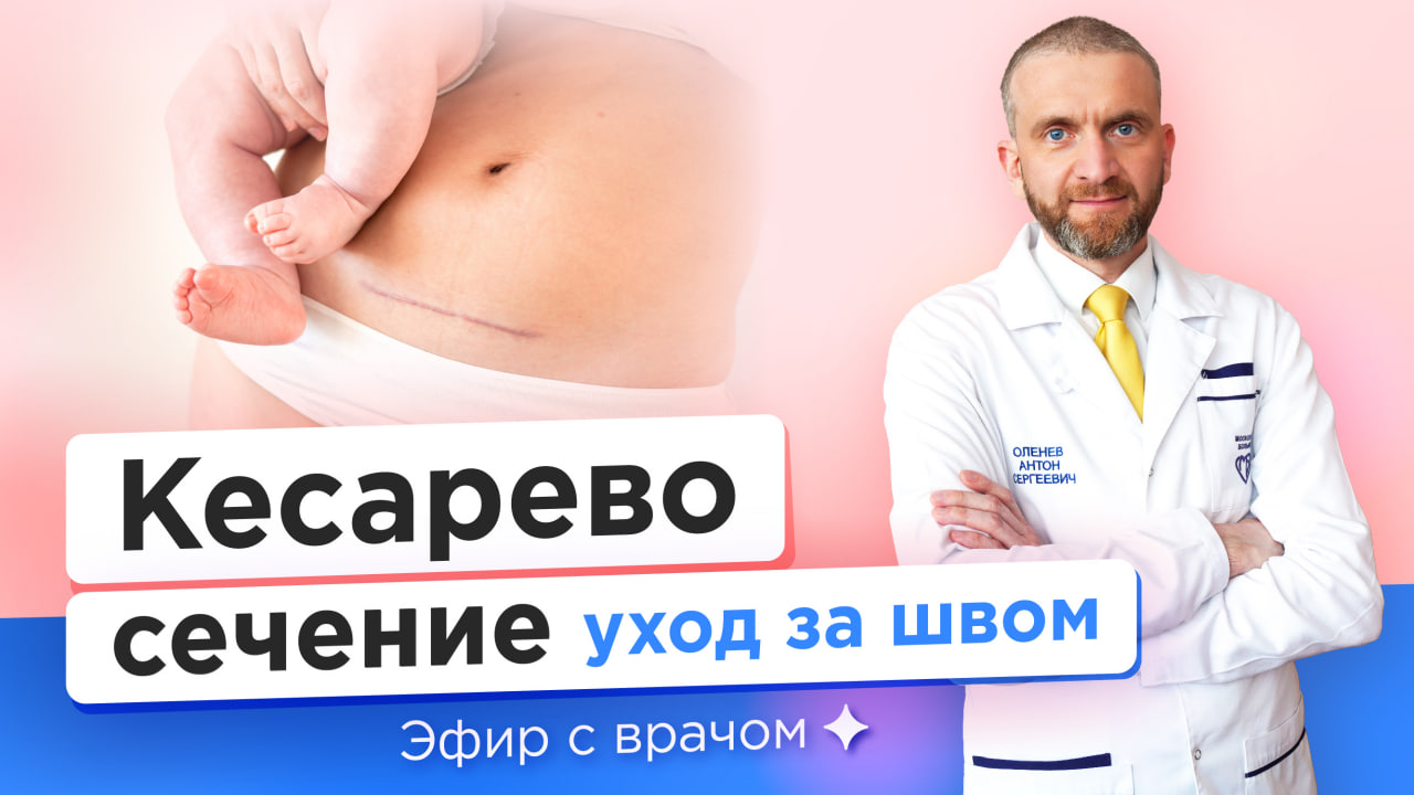 Кесарево сечение: уход за швом