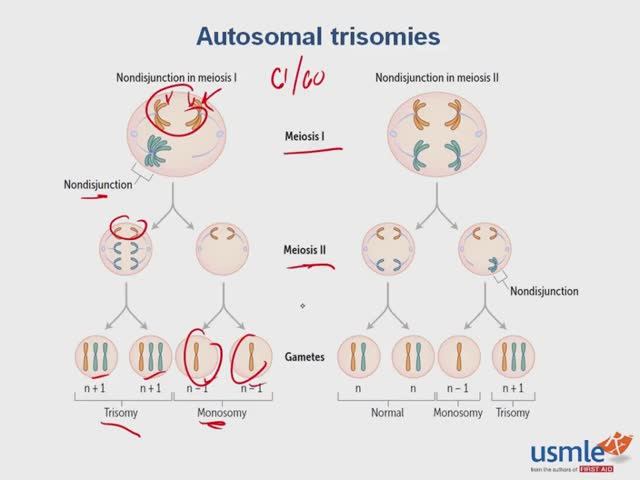 USMLE RX - 1.Биохимия - 2.Генетика -  4.Аутосомные трисомии