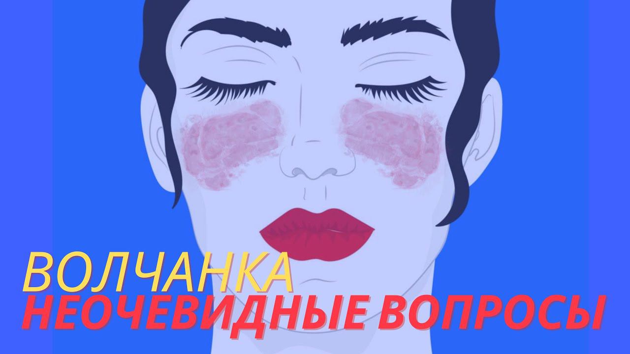 Системная красная волчанка: неочевидные вопросы