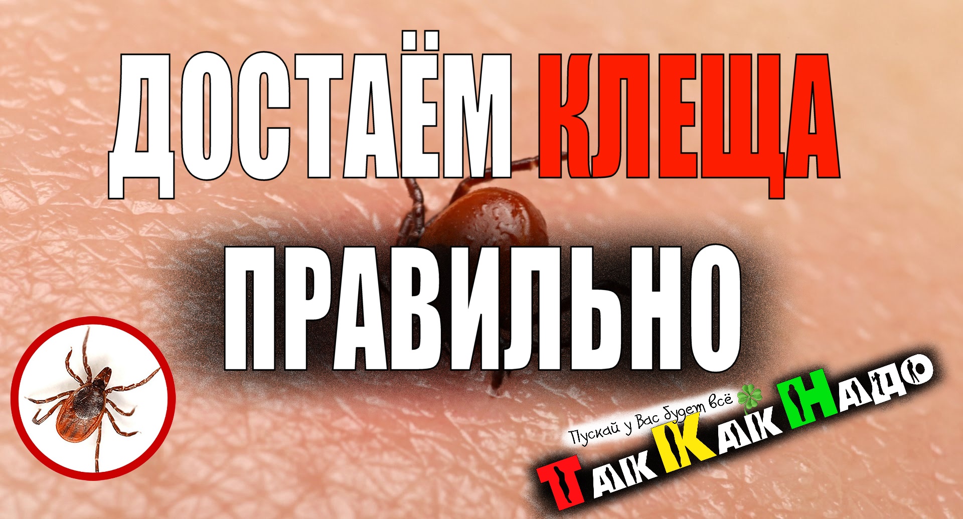 КАК ПРАВИЛЬНО ВЫТАЩИТЬ КЛЕЩА. 100% метод в период коронавирусной пандемии.