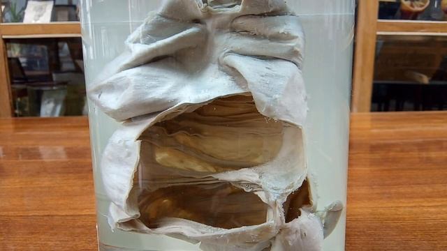 Тонкая и толстая кишка