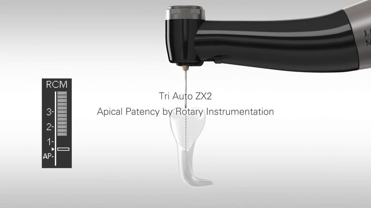 TriAuto ZX2 - Создание проходимости апикального отверстия вращающимся инструментом + OAS