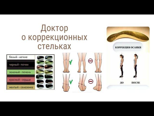 Коррекционные стельки с анионами Гучжэнцзи компании Whieda. Отзыв врача