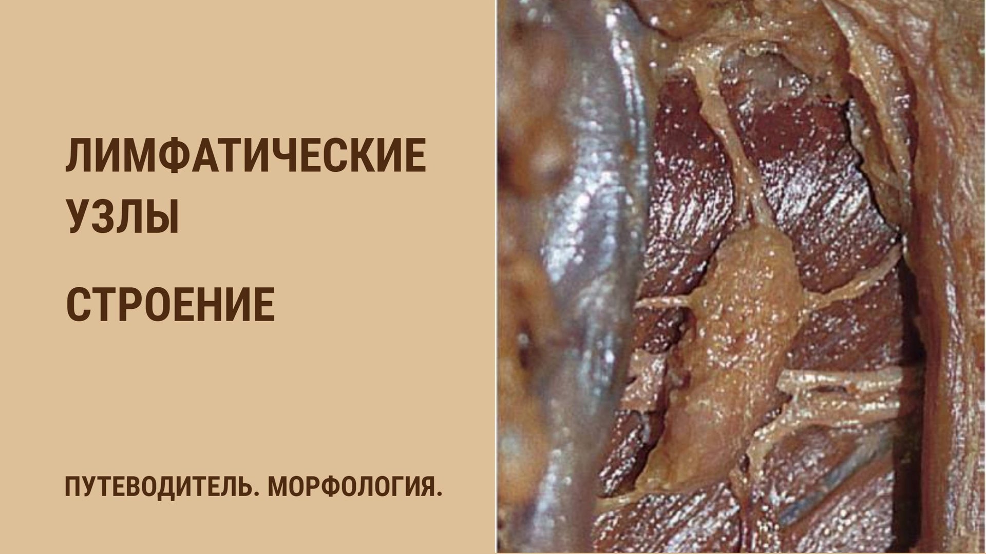 Лимфатические узлы. Строение