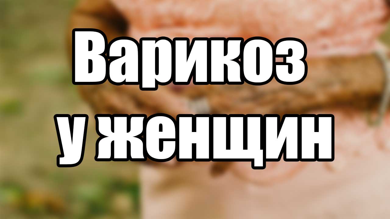 Варикоз у женщин. Варикозное расширение вен. Симптомы. Причины. Профилактика.