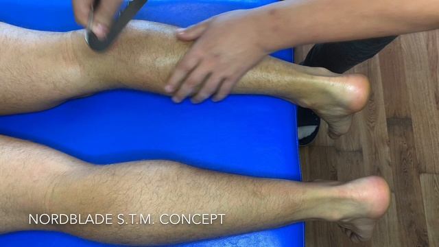 Работа с триггерной точкой в трехглавой мишце голени. NordBlade 2.0 и 3.0. ИММТ Павел Коломиец.