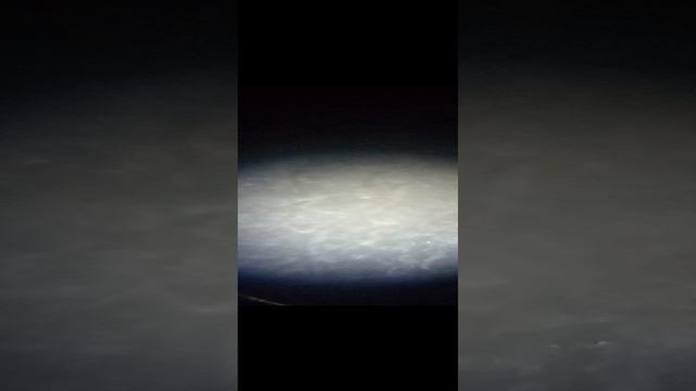 Верхний слой кожи человека под микроскопом