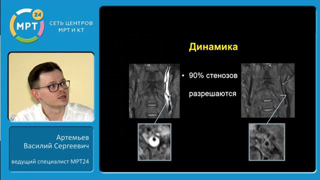 МР- ангиография