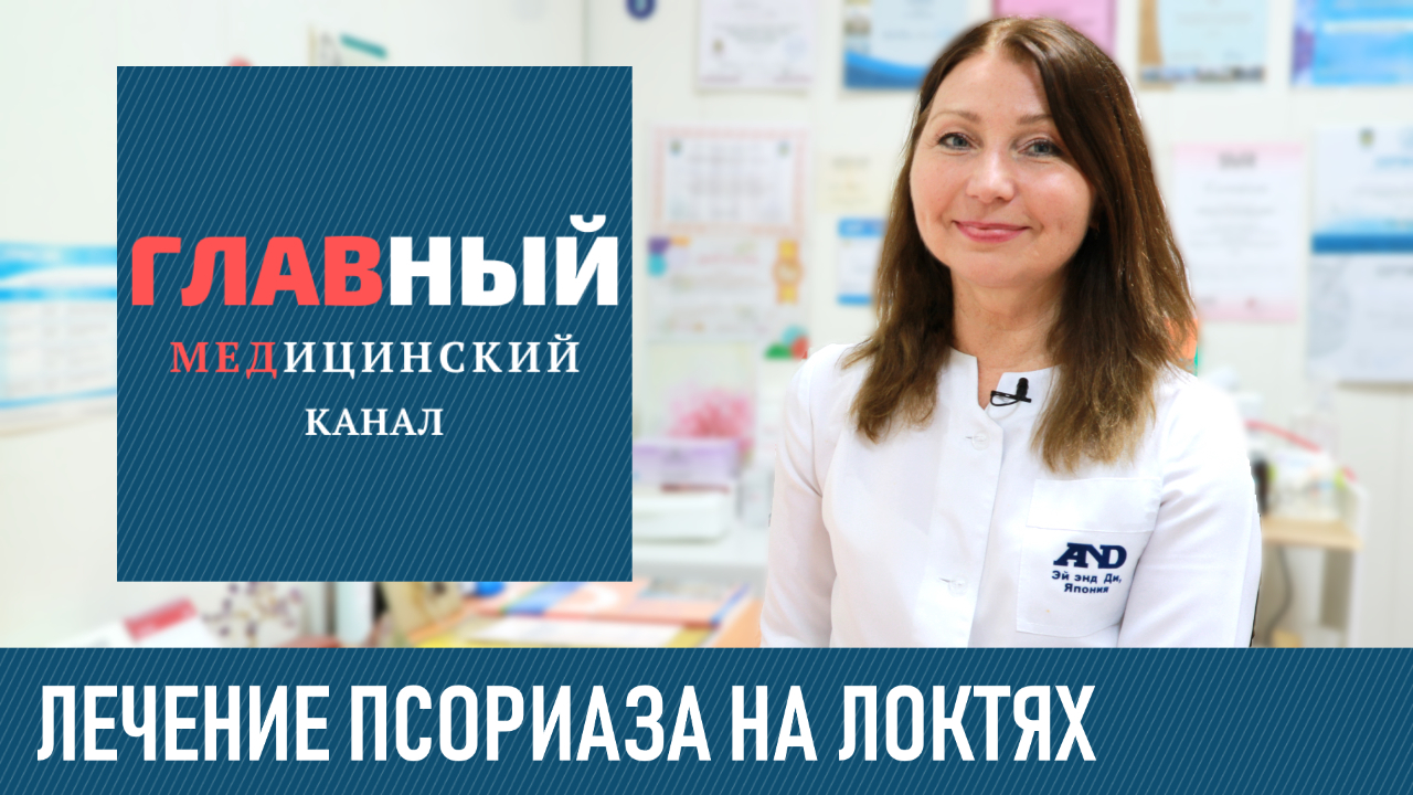 Псориаз на локтях. Лечение псориаза на локтях в домашних условиях. Как и чем лечить псориаз локтей