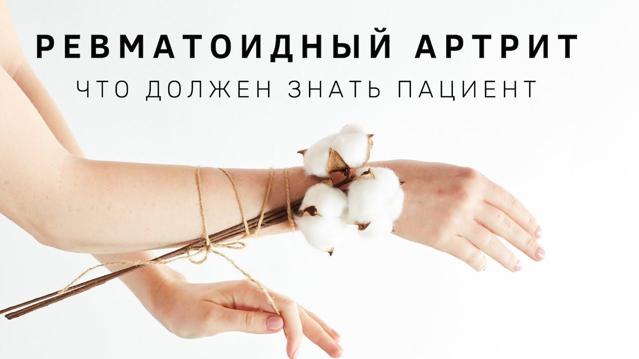 Ревматоидный артрит: что должен знать пациент. Лекция д.м.н. Н.В.Чичасовой