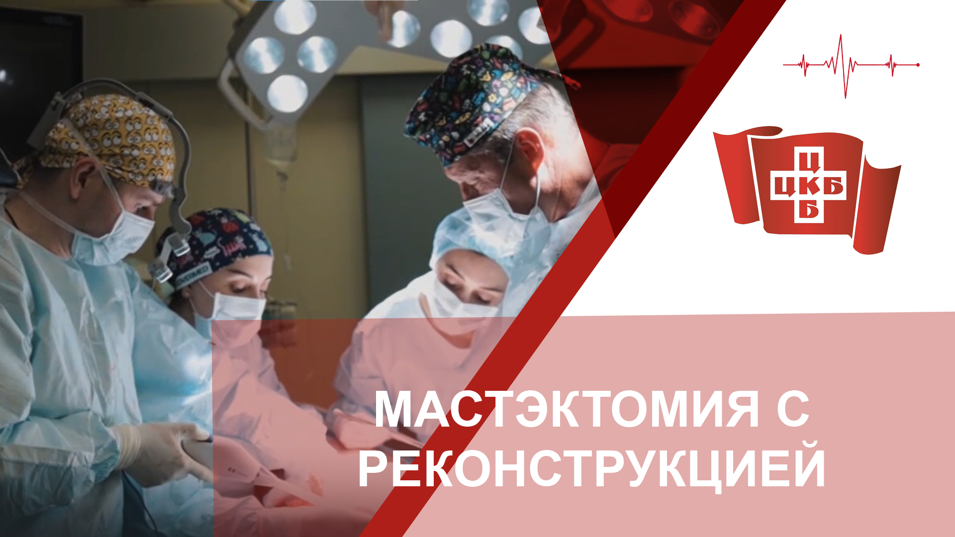 Мастэктомия с реконструкцией